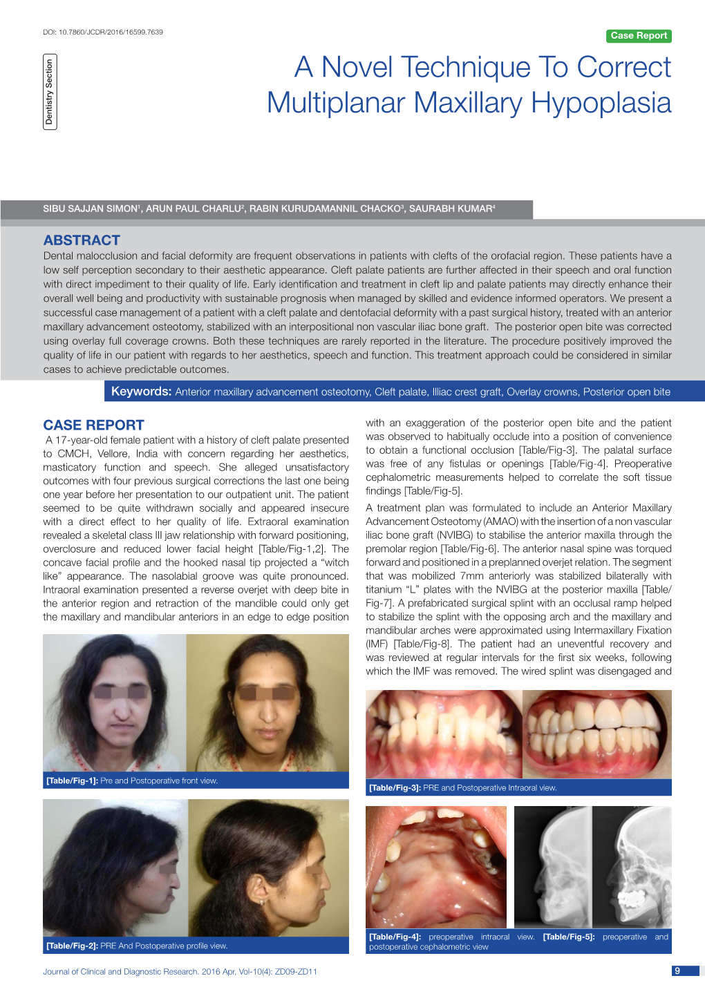 A Novel Technique to Correct Multiplanar Maxillary Hypoplasia Dentistry ...