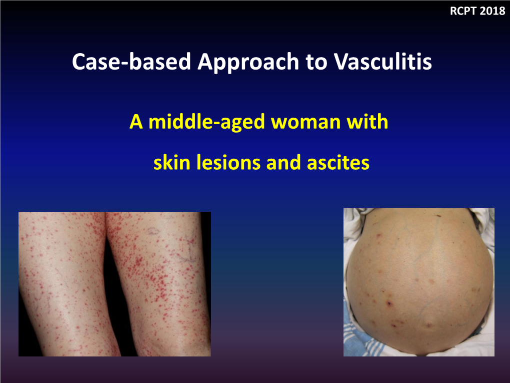 Case-Based Approach to Vasculitis - DocsLib