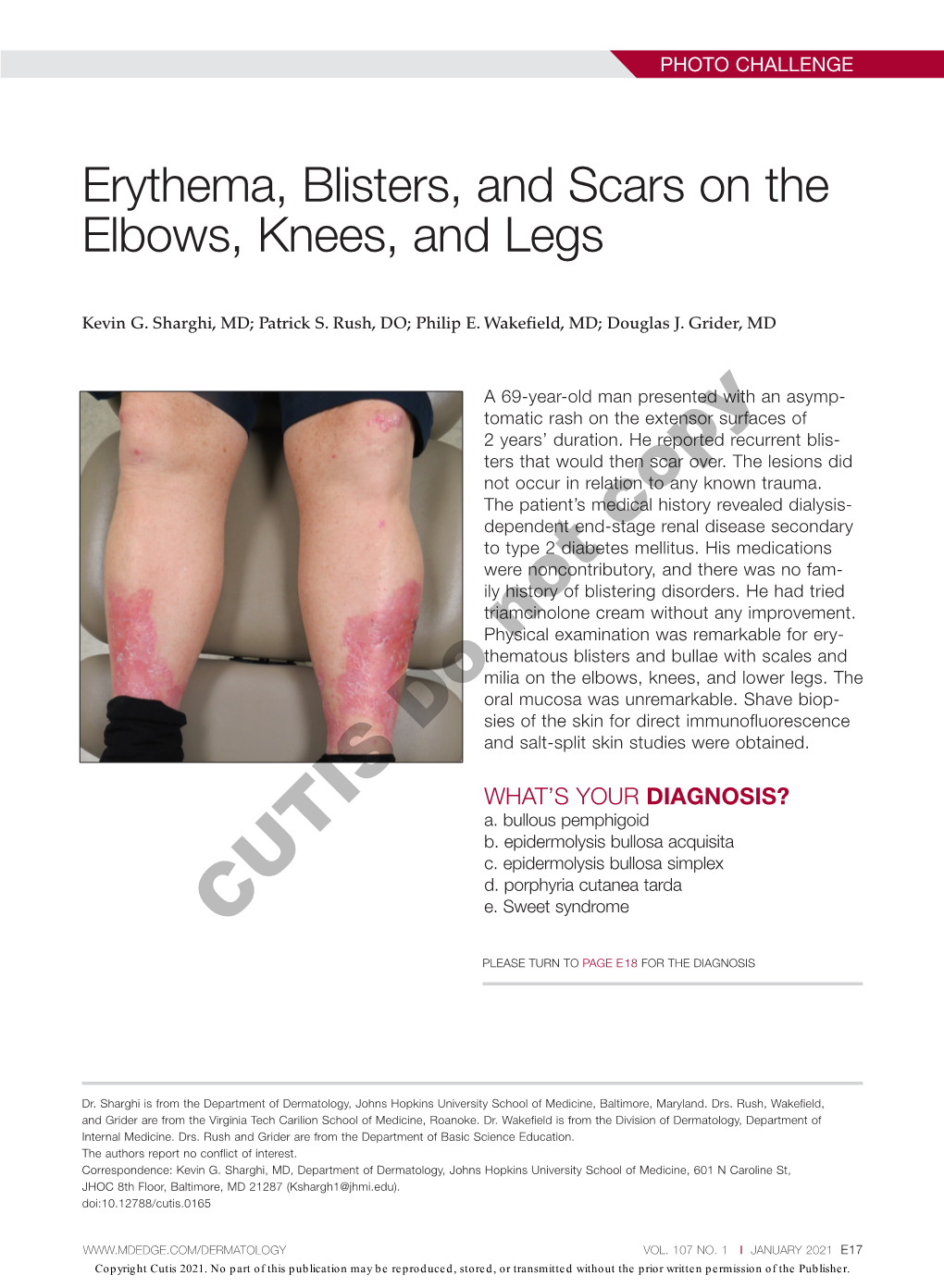 Erythema, Blisters, and Scars on the Elbows, Knees, and Legs - DocsLib